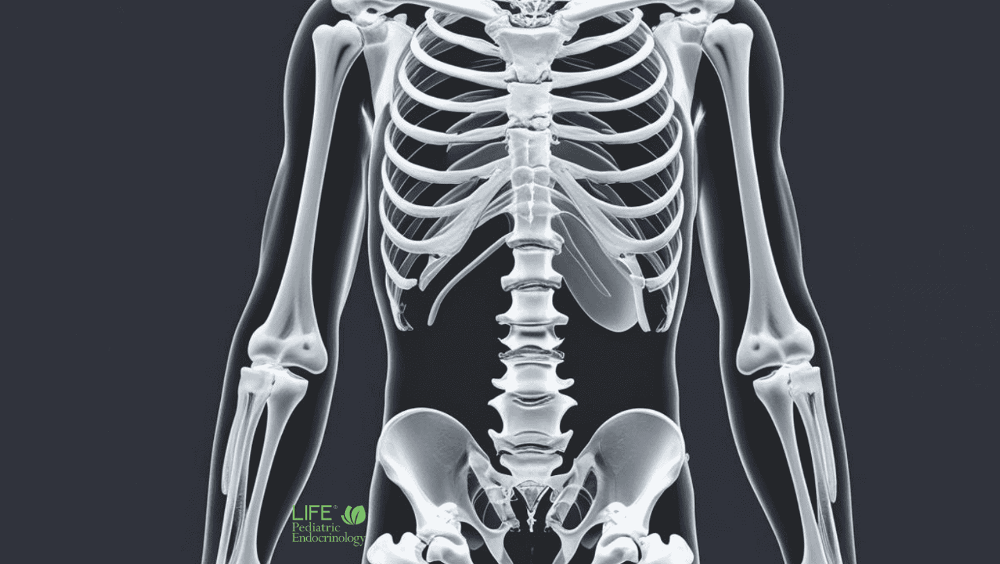 What Is Osteogenesis Imperfecta?