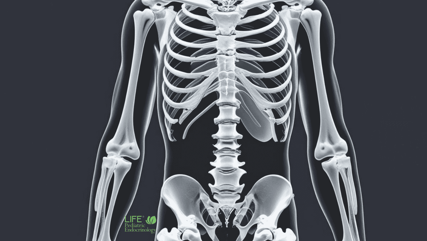 What Is Bone Disease? Understanding Causes, Symptoms, and Treatments